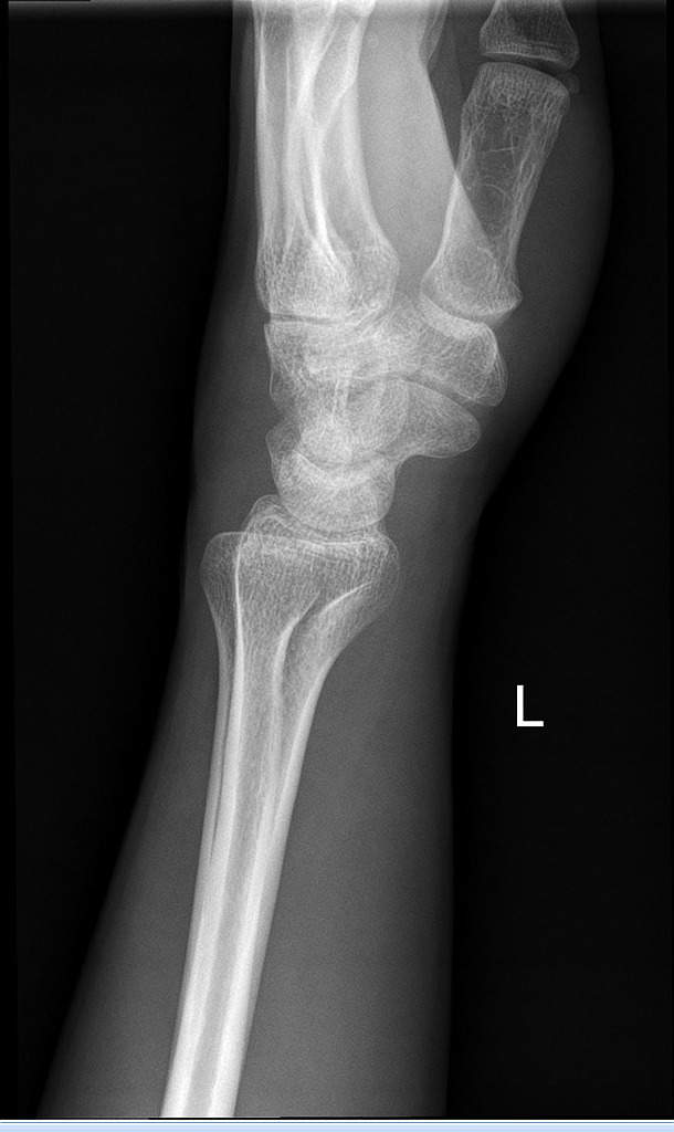 Hands Object Detection Dataset and Pre-Trained Model by Logans Space