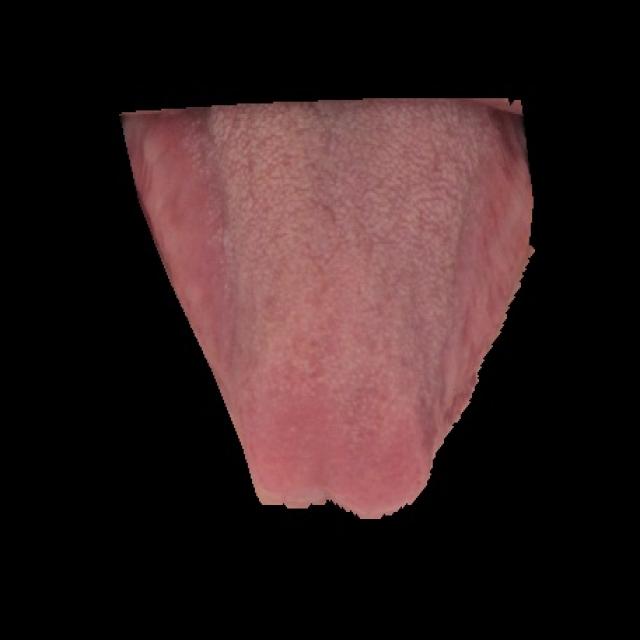 greasy Object Detection Model by PANDA