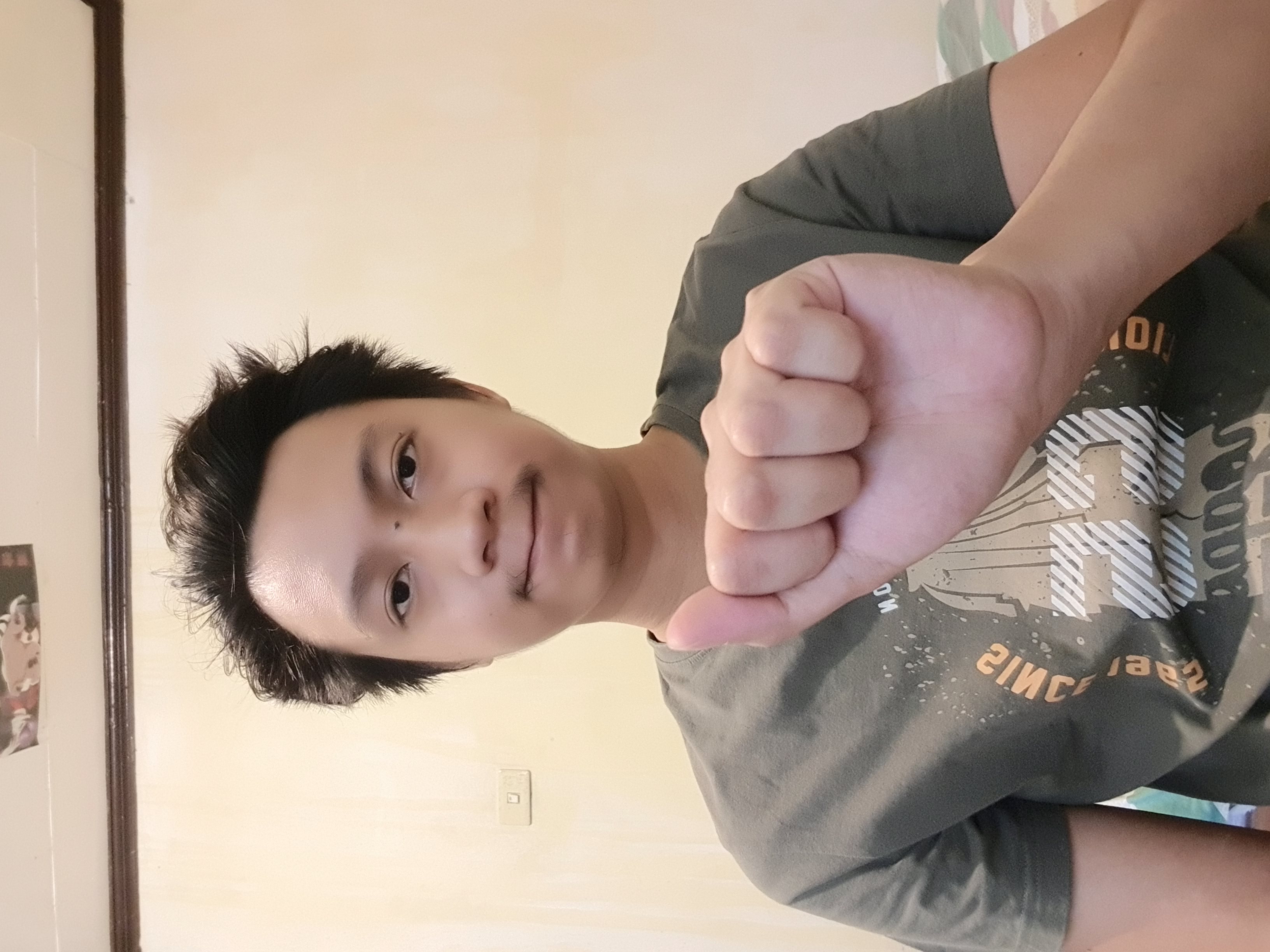 FSL V3 Object Detection Dataset by Skin diseases