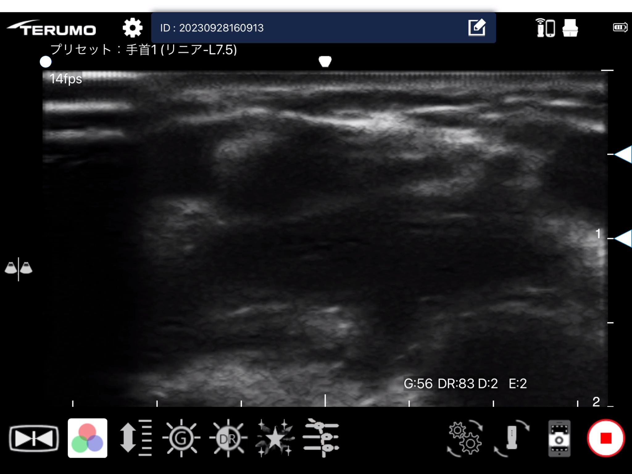 kimura_hidariude2 Object Detection Dataset by new-workspace-t7liu