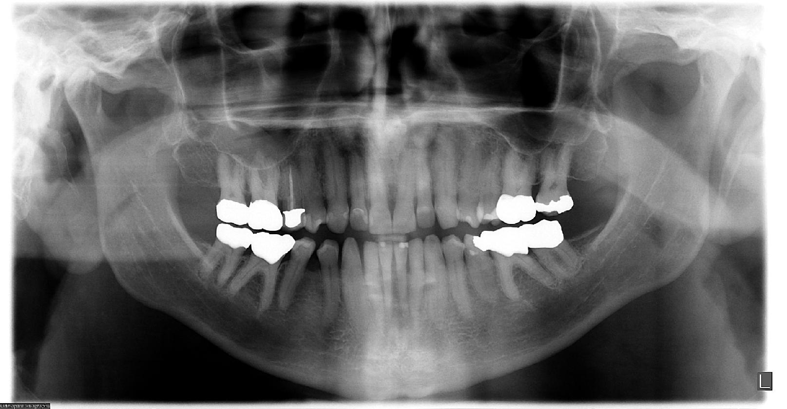 Dental Classification Model by Musah Abdulazeez