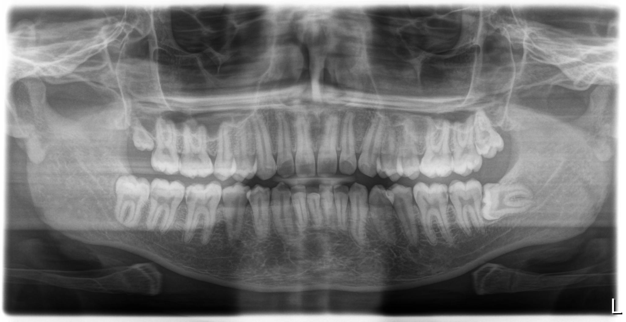 Onion Instance Segmentation Model by Imams Workspace