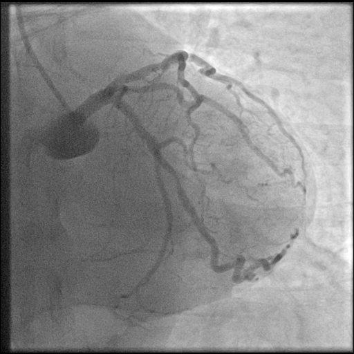 arcade Instance Segmentation Dataset by fecia