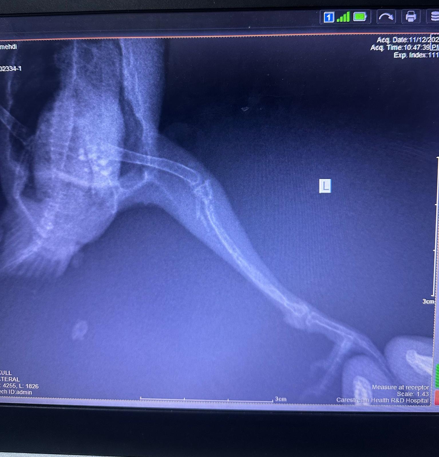 Xray Object Detection Dataset And Pre Trained Model By Esra M