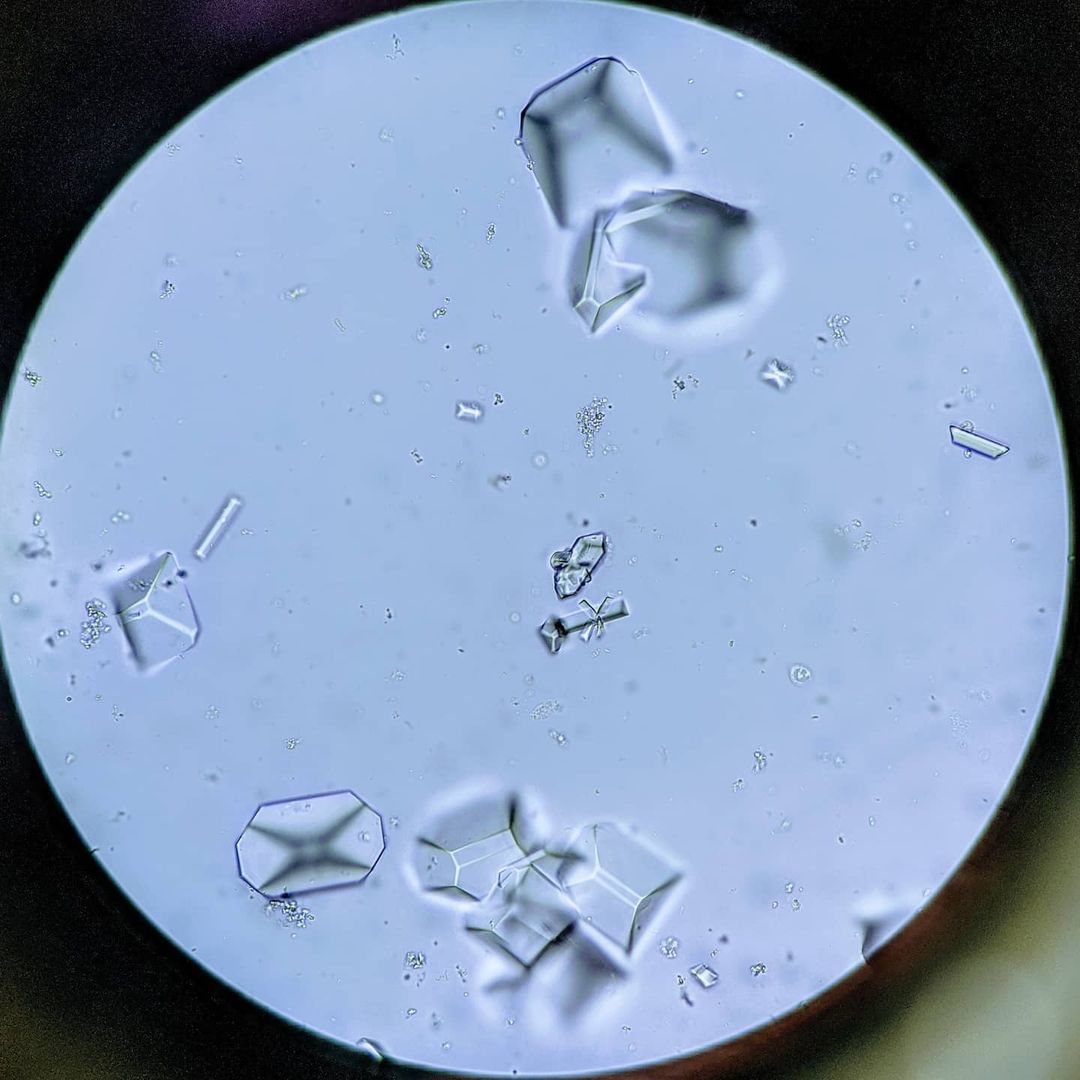 Urine Crystals Object Detection Dataset by Joshua Nogalo