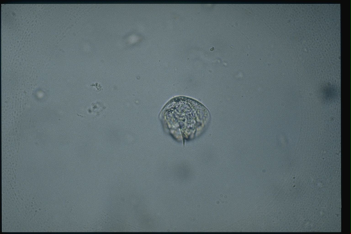 Emds G044 Object Detection Dataset By Omdena Detecting Micro In Water