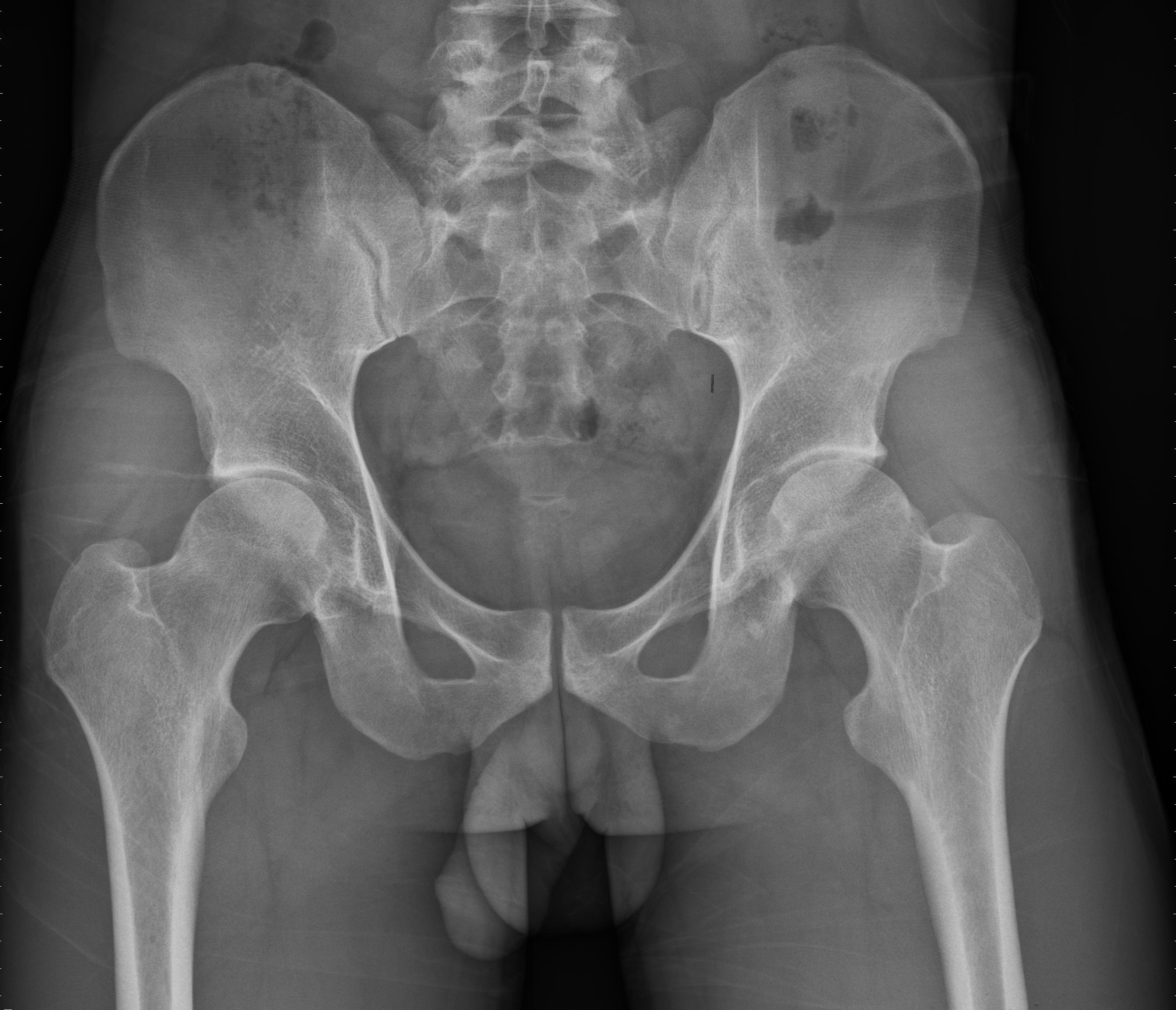 My First Project Semantic Segmentation Dataset (v2, 2025-02-19 11:04pm) by FRACTURE