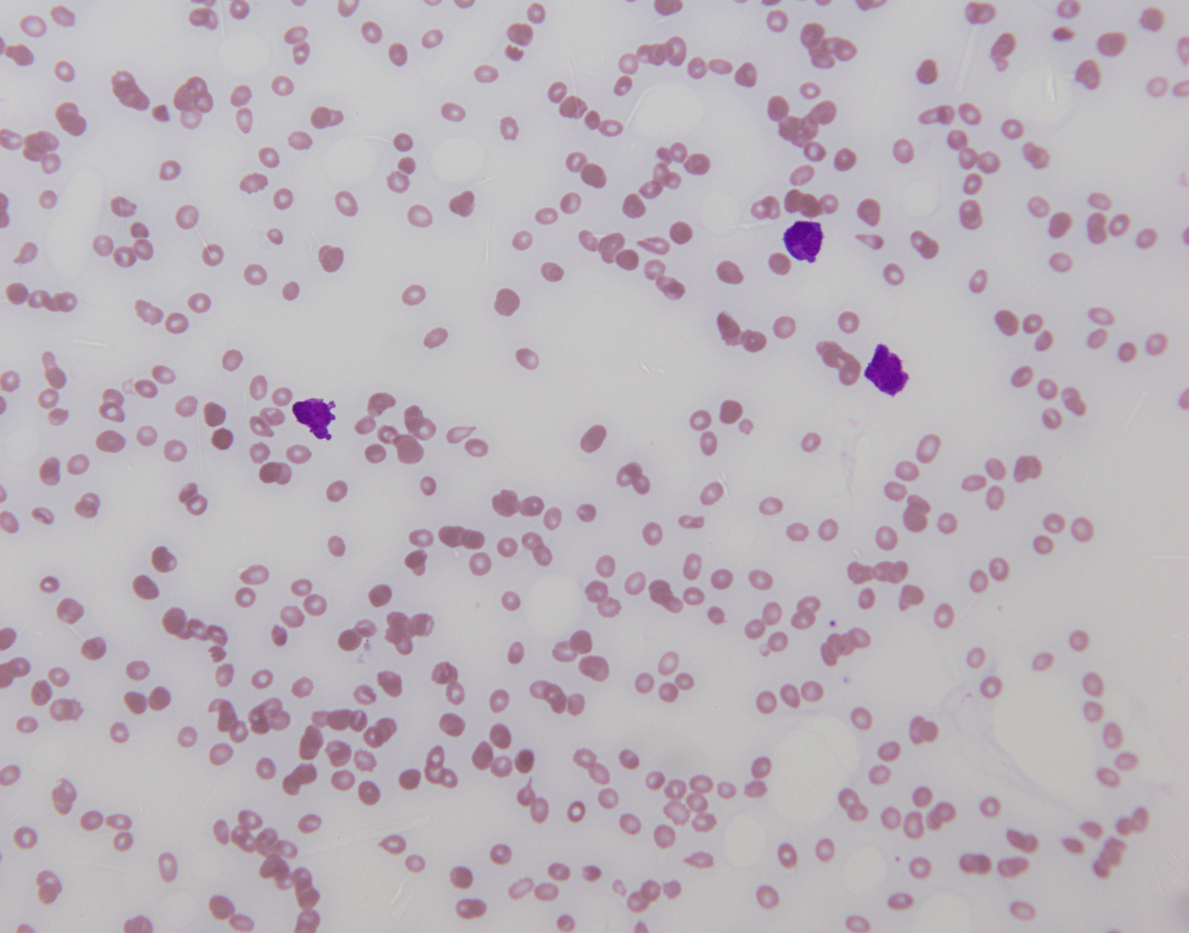 Leukemia-Detection Object Detection Model by Zheng
