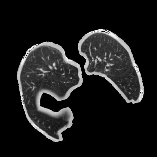 Detection Object Detection Model By Rossa