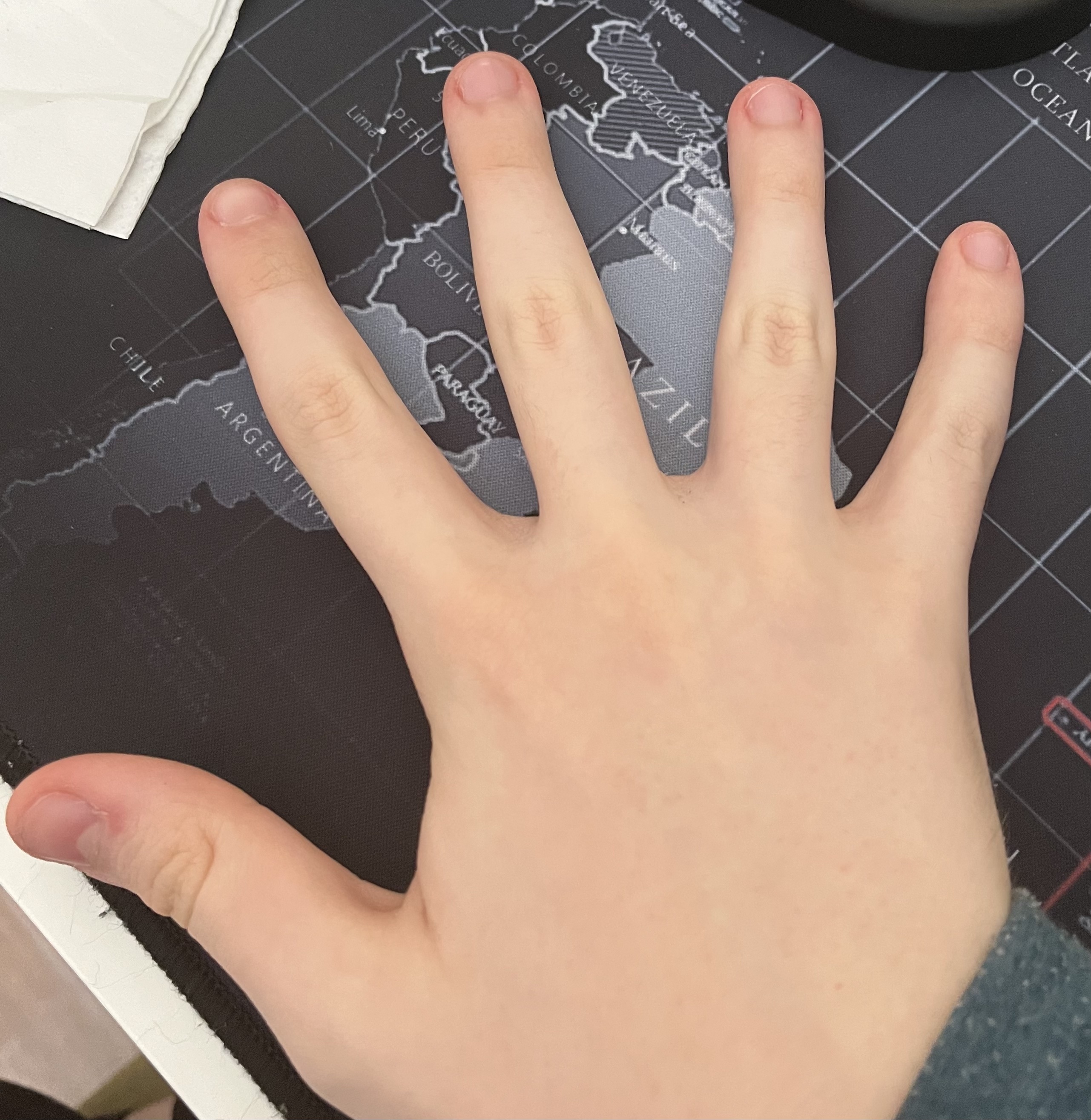 hand Keypoint Detection Dataset by handdet