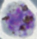 test schizont Classification Dataset by DTGCN