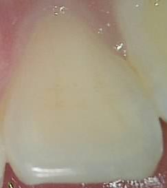 (resize)tooth-type-detection Object Detection Model by smartodontogram