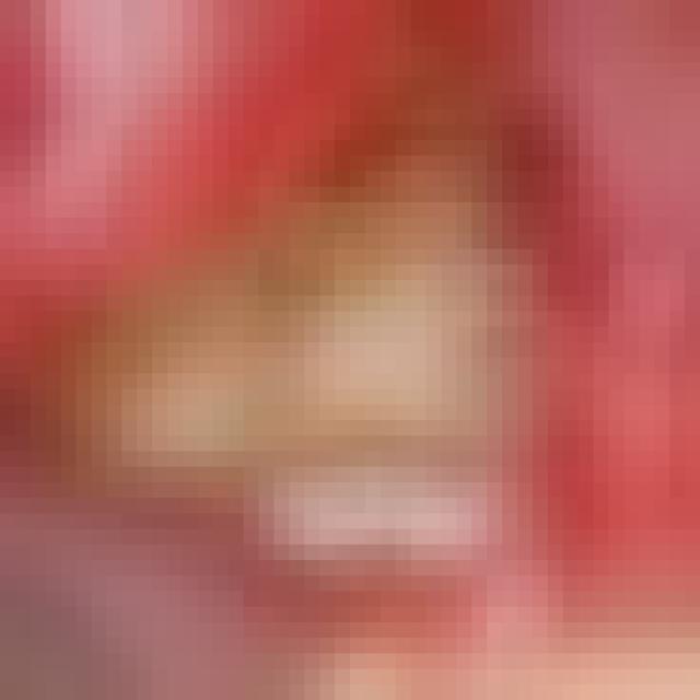 caries2 Object Detection Model by Ahsans workspace