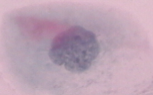 cervix detection Computer Vision Dataset by Cervixtype