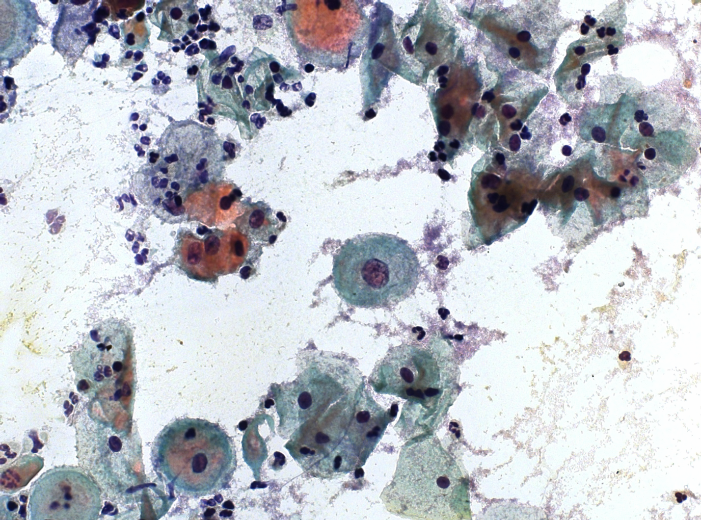 Cervical Cancer Classification 2 Classification Model by ML