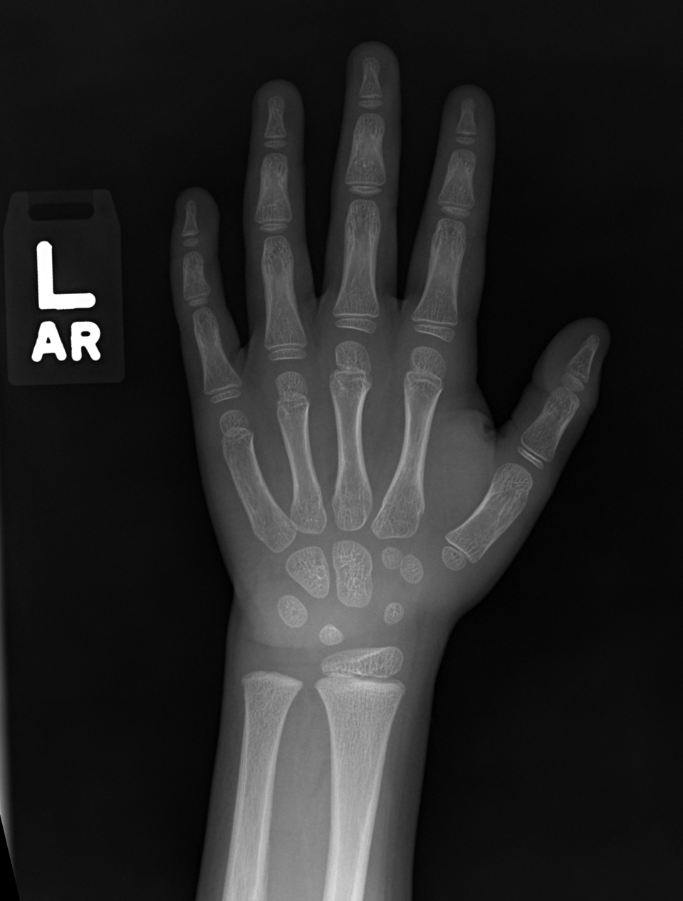 bone Classification Model by bones