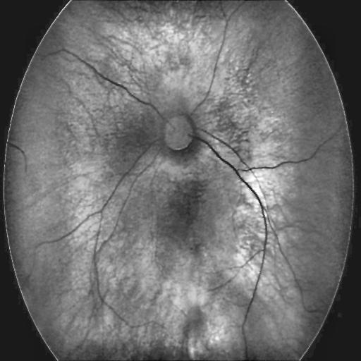 retina_classification Classification Model by Ali