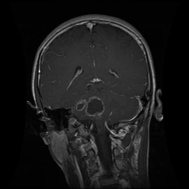 MRI-Classification Classification Dataset by disertatie