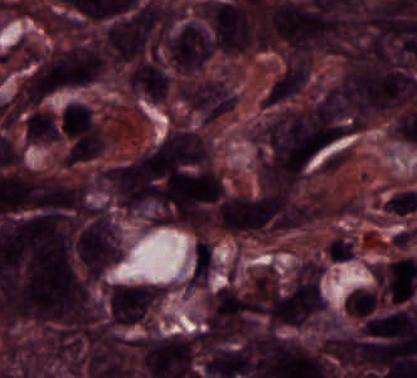 Cell_Image Object Detection Dataset and Pre-Trained Model by SIRIYAKORN ...