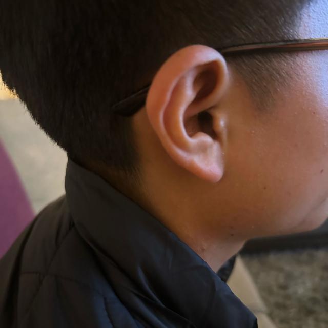 Ear-Measurement-Pose Keypoint Detection Dataset by Ai