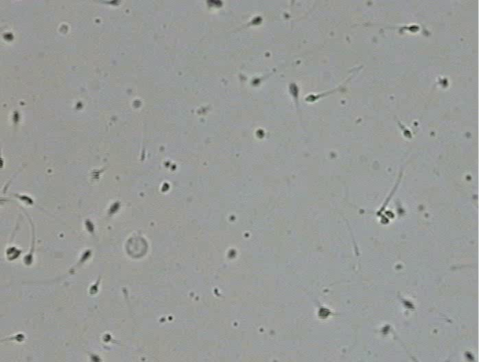 sperm detectionV4 Object Detection Dataset and Pre-Trained Model by Modular