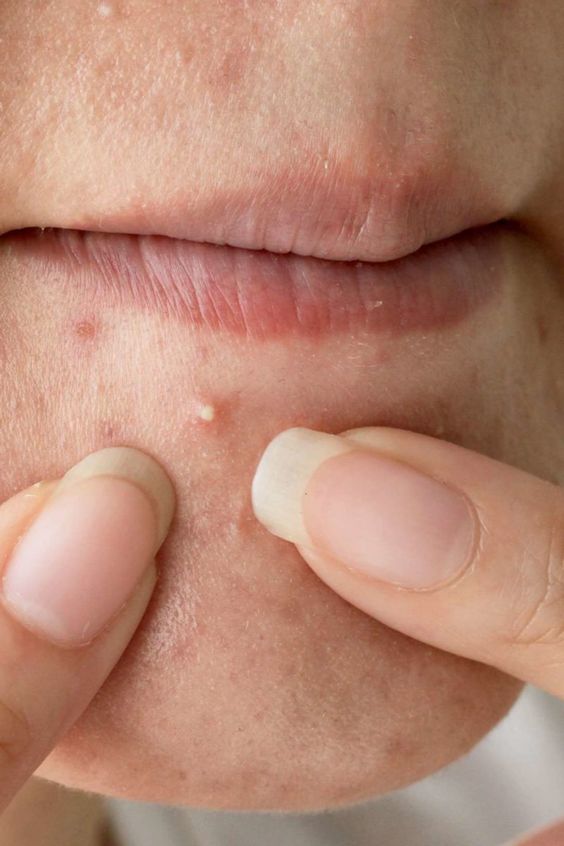 Skripsi Final Object Detection Dataset By Sarjana Teknik