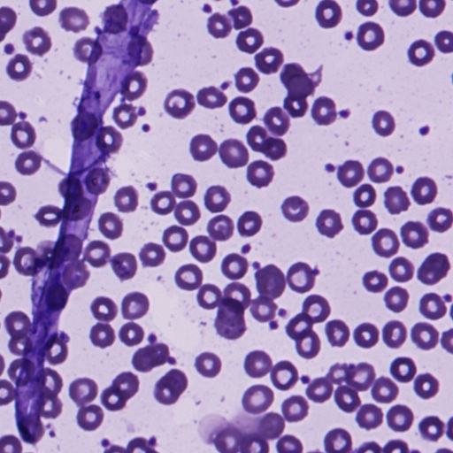 White blood cells detection Object Detection Dataset and Pre-Trained Model by Shirley