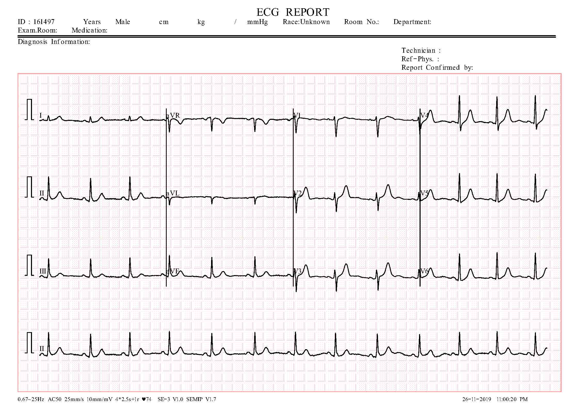 ECG image classification Classification Dataset by computer science ECG image classification Classification Dataset by computer science