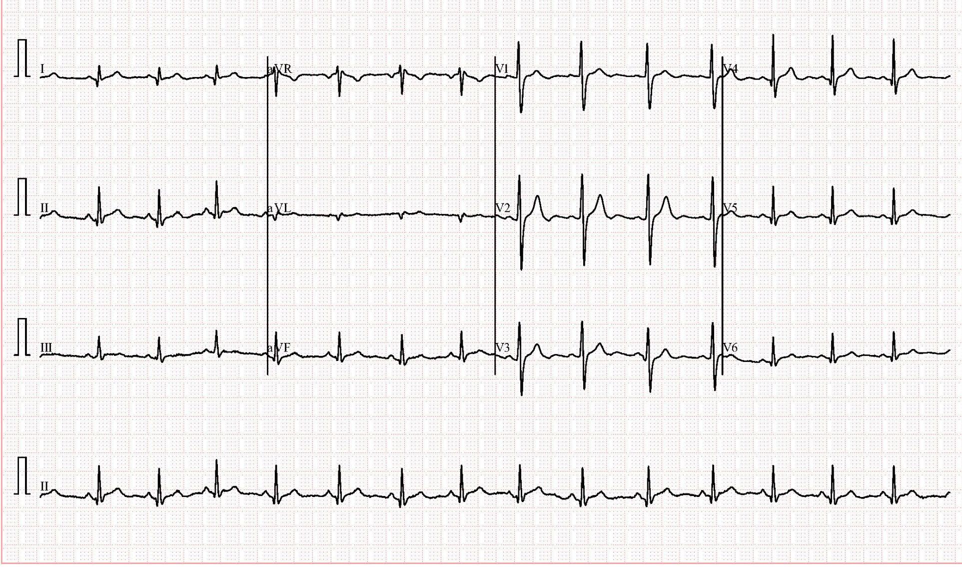 resize image Classification Dataset by computer science