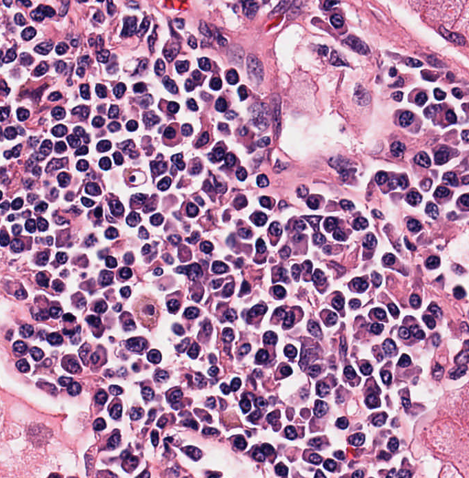 owais Instance Segmentation Dataset by Muhammad Owais