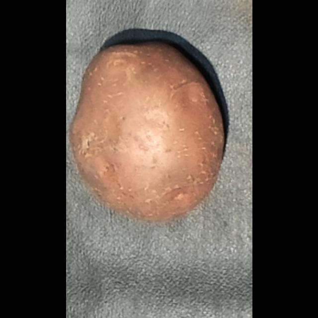 Detecting-Potato Object Detection Dataset by stockvision