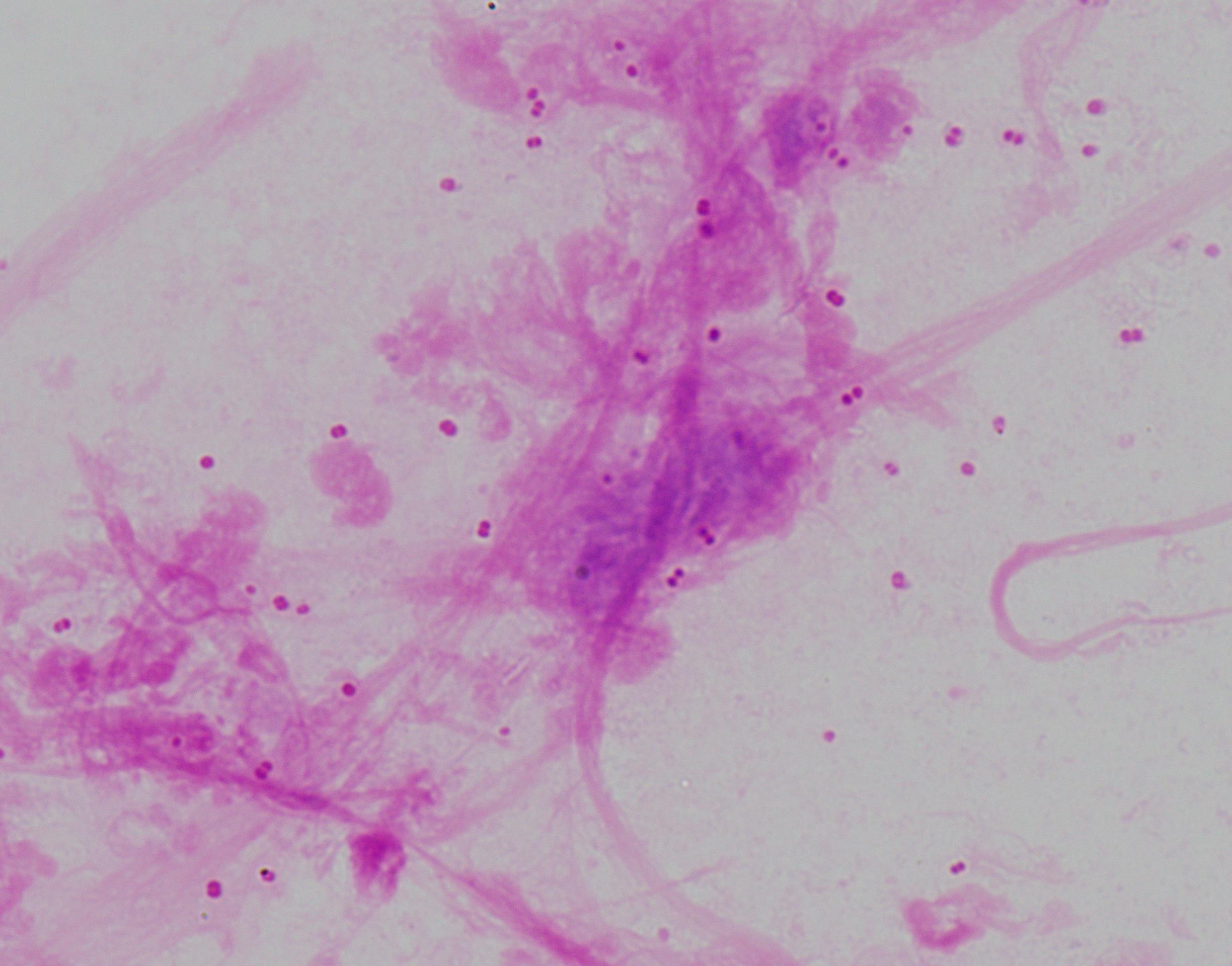 aaa Object Detection Dataset by new-workspace-0tbw7