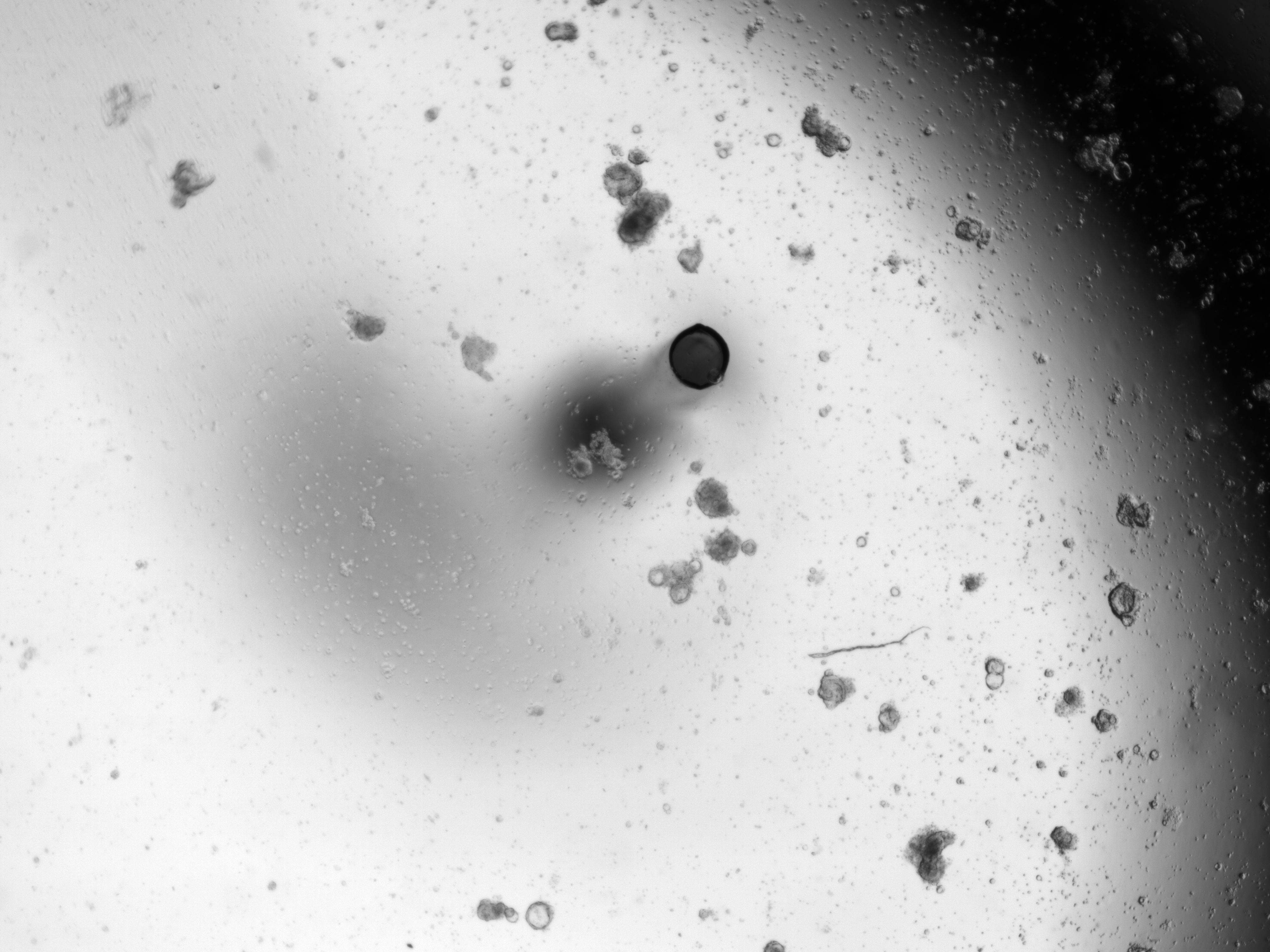 organoids detection Instance Segmentation Dataset and Pre-Trained Model by hytCC