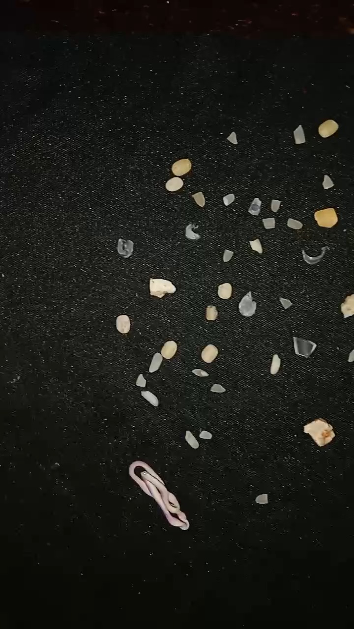 Rice Quality 3 Object Detection Model By Project