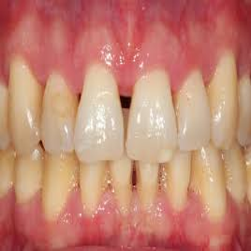 teeth Object Detection Dataset by Kim Taehwan