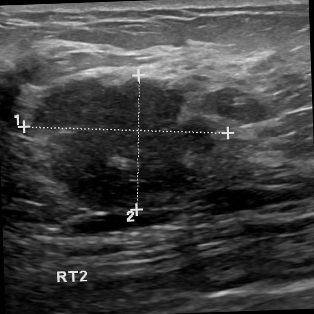 Object Segmentation Object Detection Dataset and Pre-Trained Model by Ica Afif