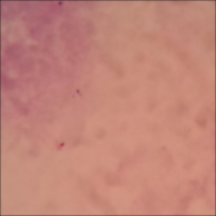 Median Gaussian Test Object Detection Dataset By Emir Fachrudin