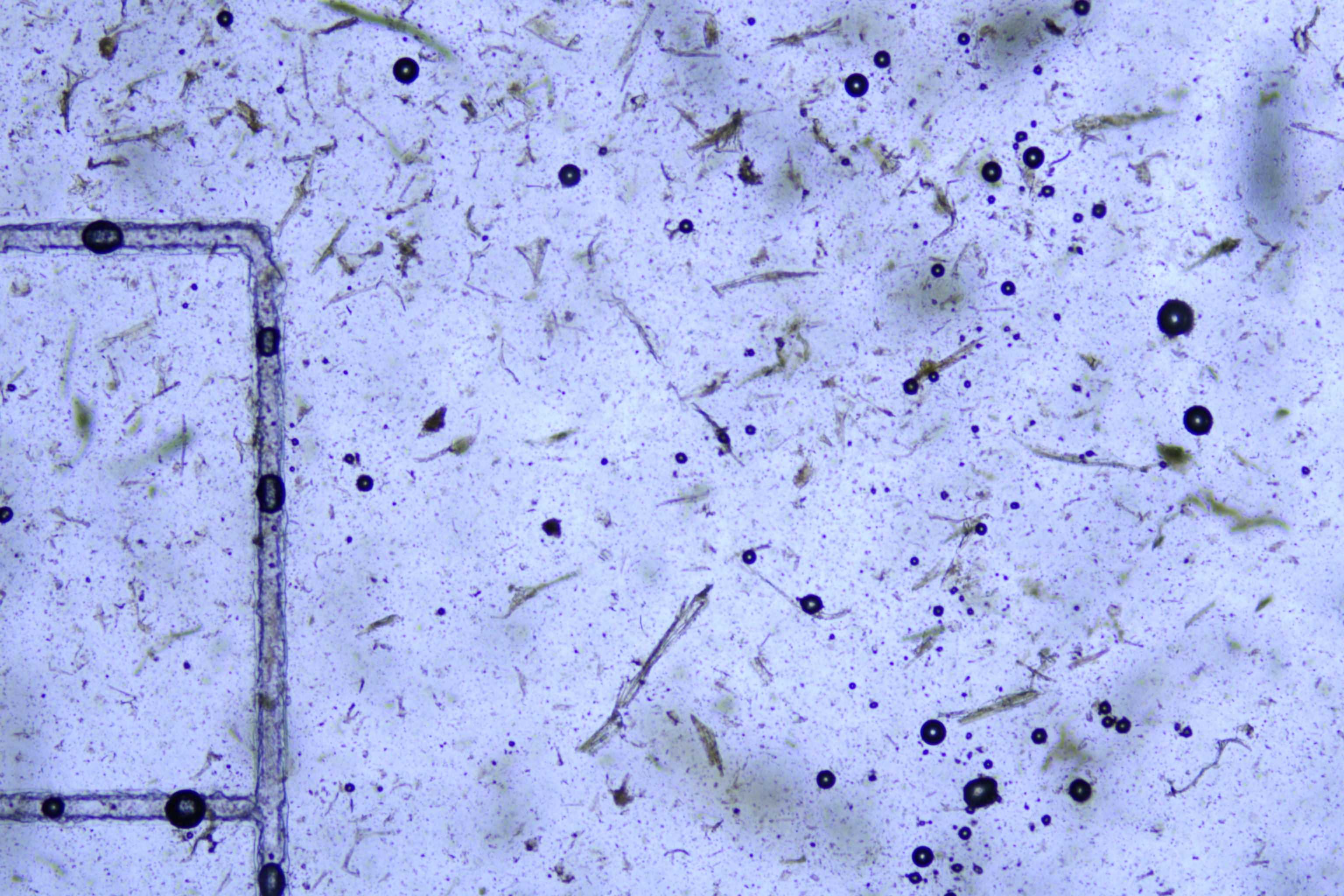 parasite Object Detection Dataset and Pre-Trained Model by Alvin