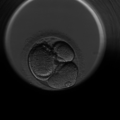 embryo_project Object Detection Model by embryoproject