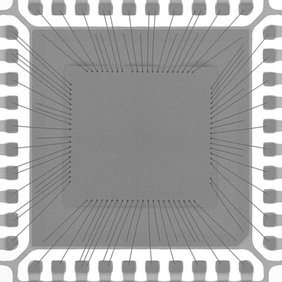 Wire X-Ray Classification Model by Wire XRay 2