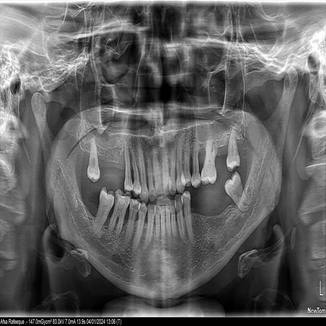 teeth Instance Segmentation Dataset by perio