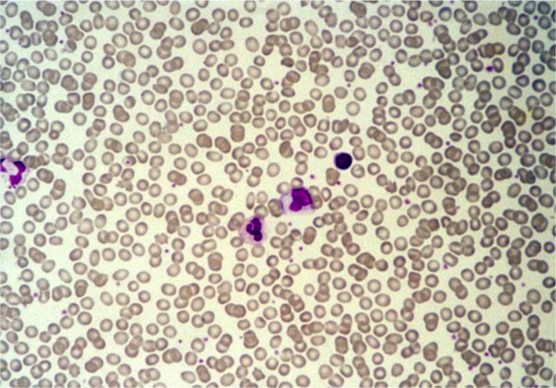 WBC-Rectangle-nonrobflow Object Detection Dataset by SIM