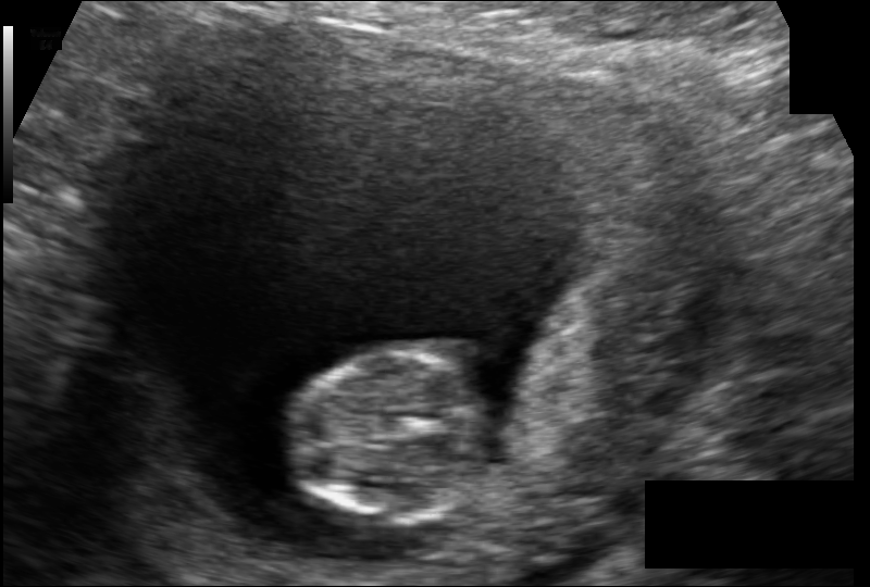 Fetal Study Classification Dataset by Upwork