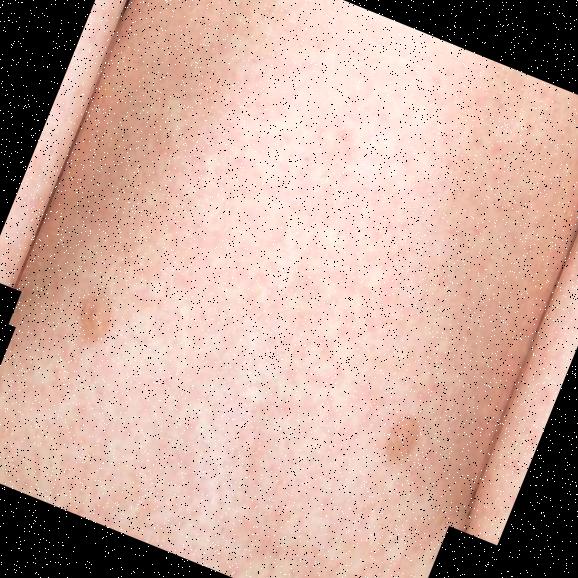 Childhood Disease Classification Model by Project