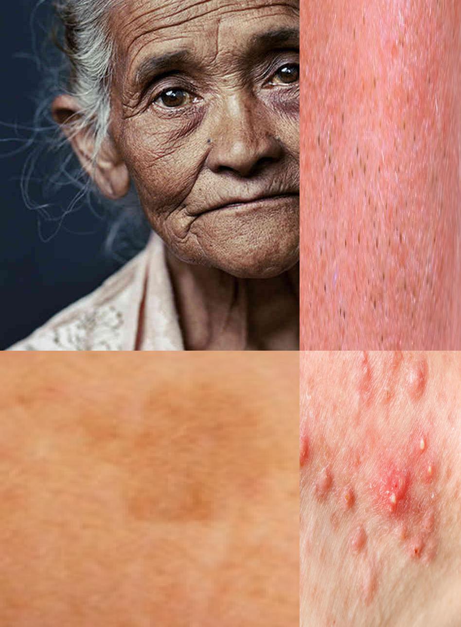 skin_problems Instance Segmentation Dataset by Sengunthar engineering college