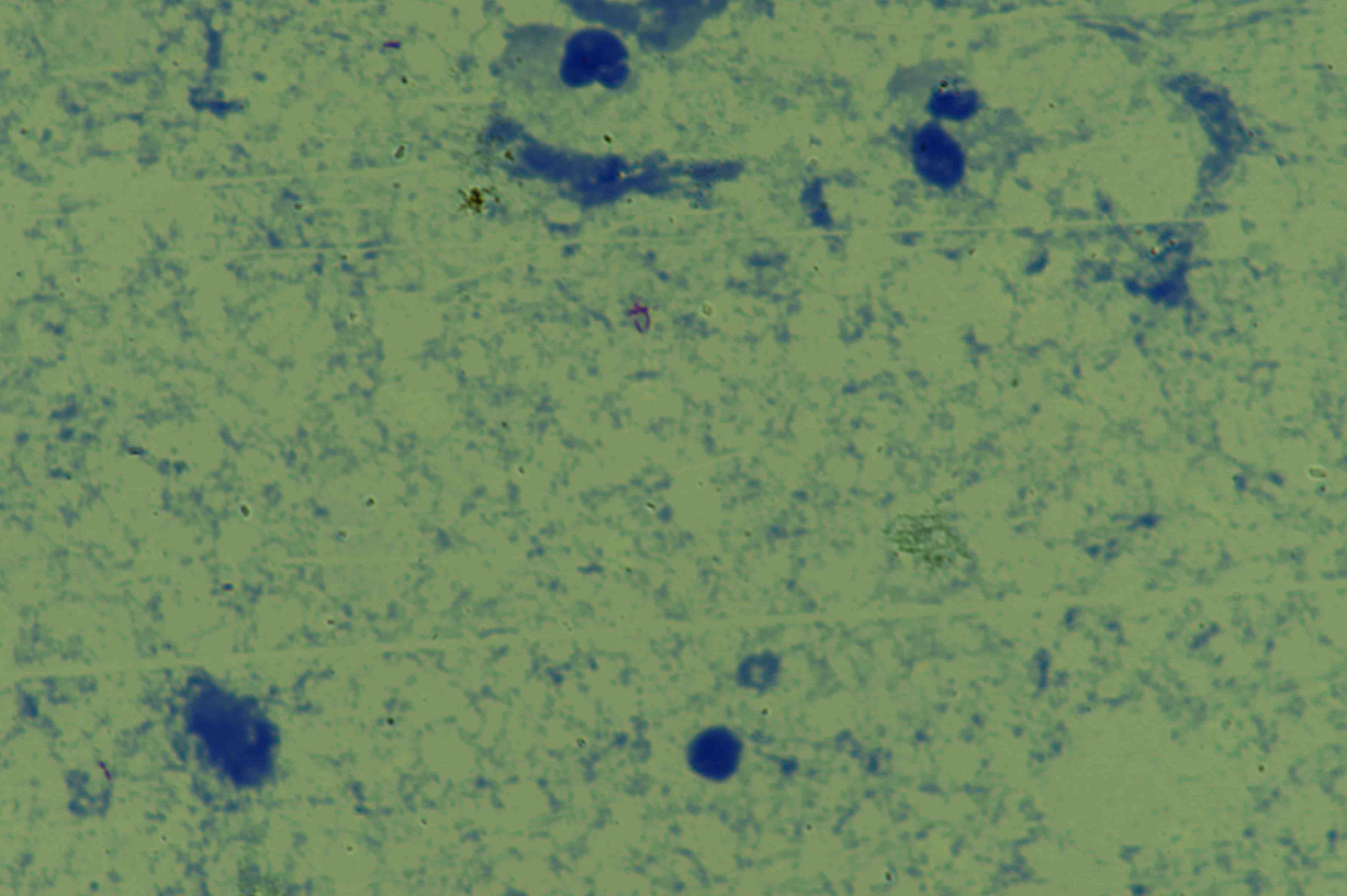 bounding box TB Object Detection Dataset by Naresuan University