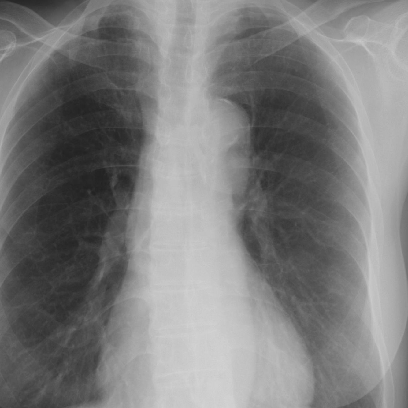 covid Classification Dataset by AliceVision