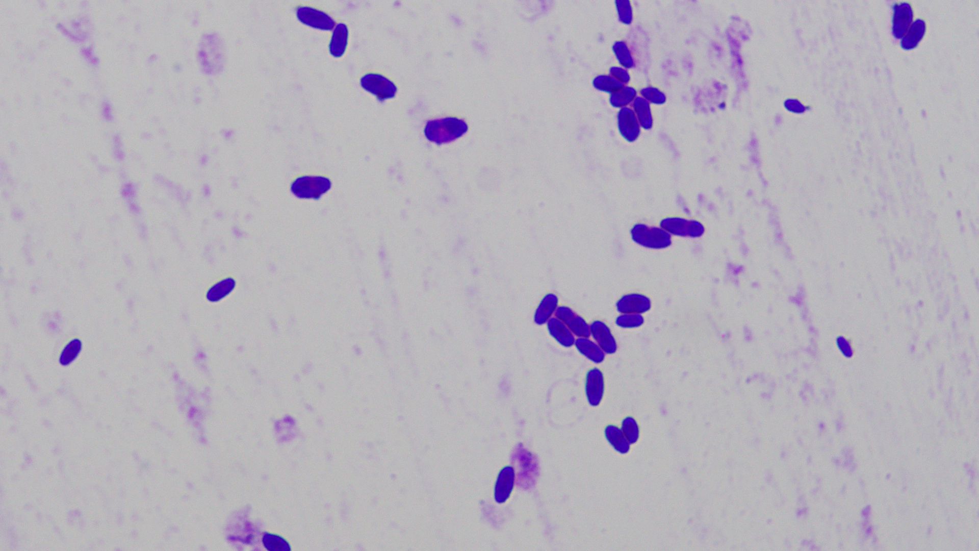 parazit Object Detection Dataset and Pre-Trained Model by parasite