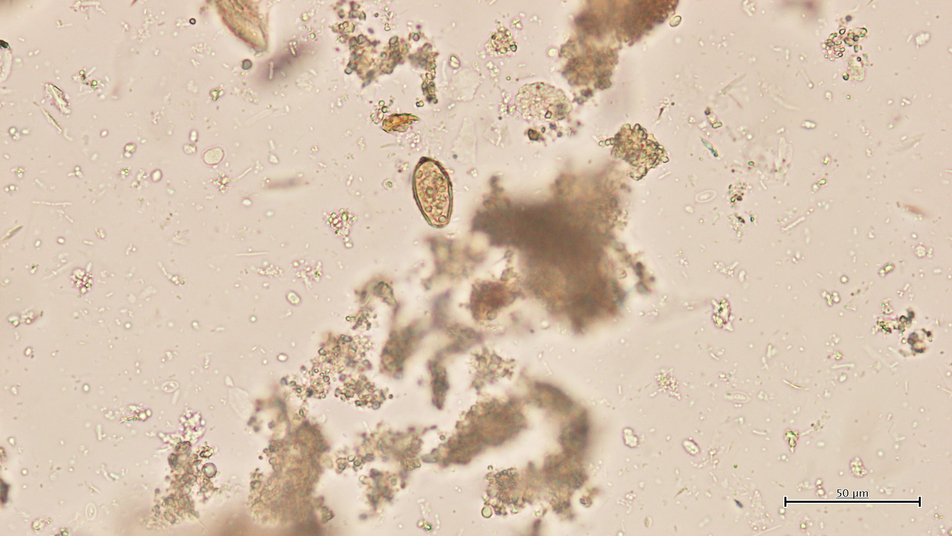 ov_annotations Object Detection Dataset by new-workspace-hn9ix