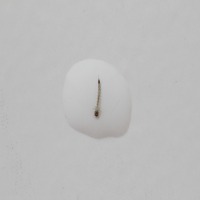 Mosquito Larvae Detection Object Detection Dataset and Pre-Trained Model by Mosquito Larvae ...